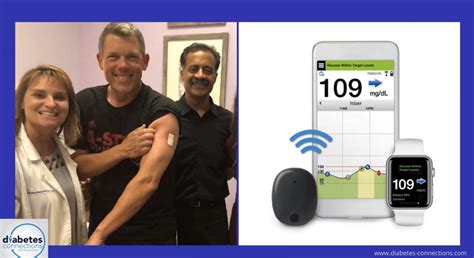 Eversense The Implantable Continuous Glucose Monitor Diabetes Daily
