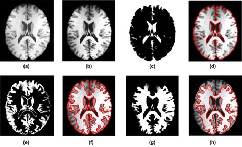 segmented mri brain tissues a b original brain image and enhanced download scientific diagram