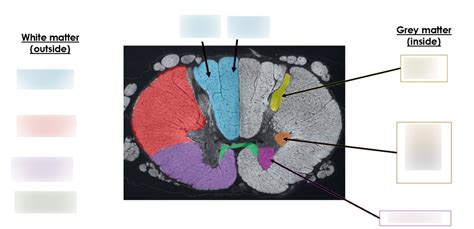 Spinal Cord Transverse Section Diagram Quizlet