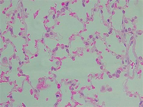Simple Squamous Epi Lung Alveoli 400x P000120 OER Commons
