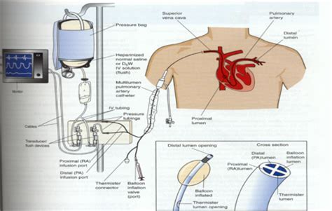 Diagnostic Tests And Procedures Flashcards Quizlet