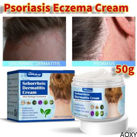 Seborrheic Dermatitis Cream Scalp Treatment Psoriasis Folliculitis