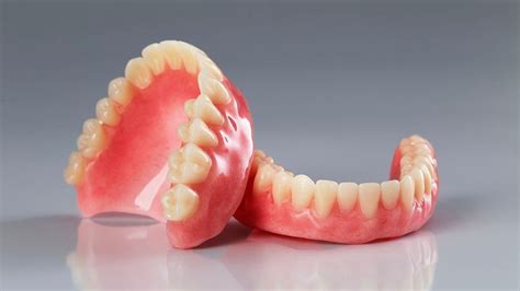 Confira o que é prótese dentária móvel e os principais tipos