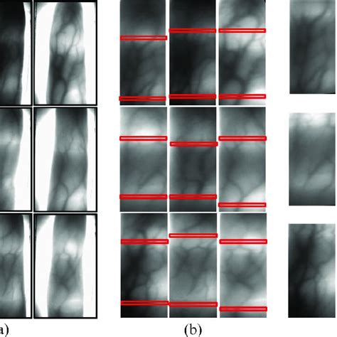 pdf gan based image augmentation for finger vein biometric recognition