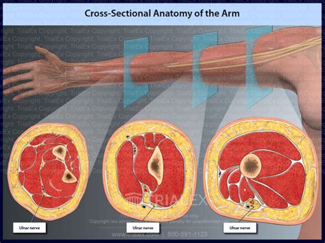 Cross Sectional Anatomy Of The Arm TrialExhibits Inc