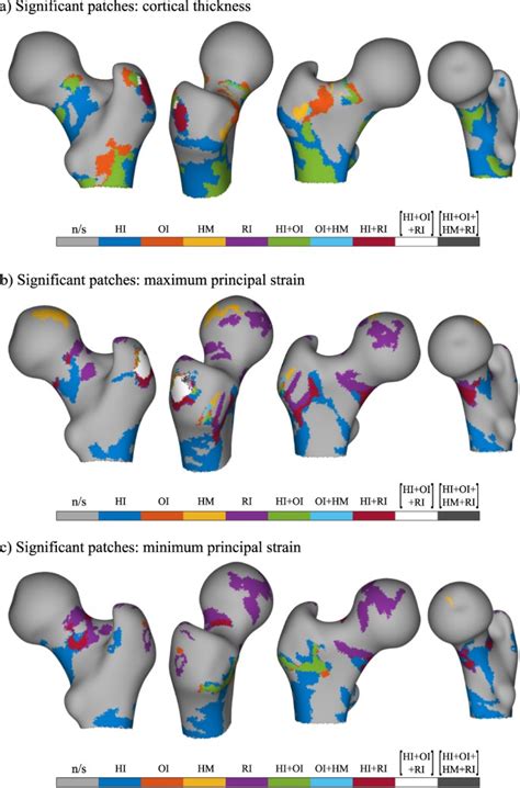 ricci flow based conformal mapping of the proximal femur to identify