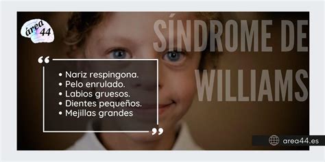 Síndrome de Williams y aprendizajeI I Área 44 Servicios Educativos
