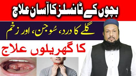 Bachon K Tonsils Ka Asan Ilaaj Gale Ke Tonsil Ka Ilaj Hakeem Mehmood