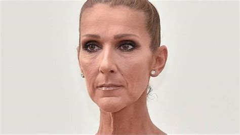 Gejala Dan Penyebab Stiff Person Syndrome Yang Dialami Celine Dion