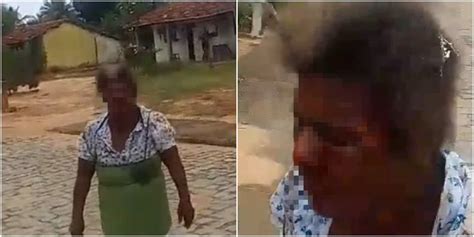 Jovem Presa Suspeita De Queimar O Rosto Da Pr Pria M E Gua