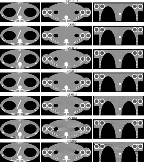 [pdf] advanced single slice rebinning in cone beam spiral ct theoretical considerations and