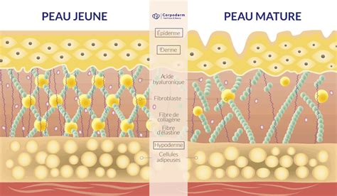Radiofréquence corps Cellulite vergetures relâchement cutané
