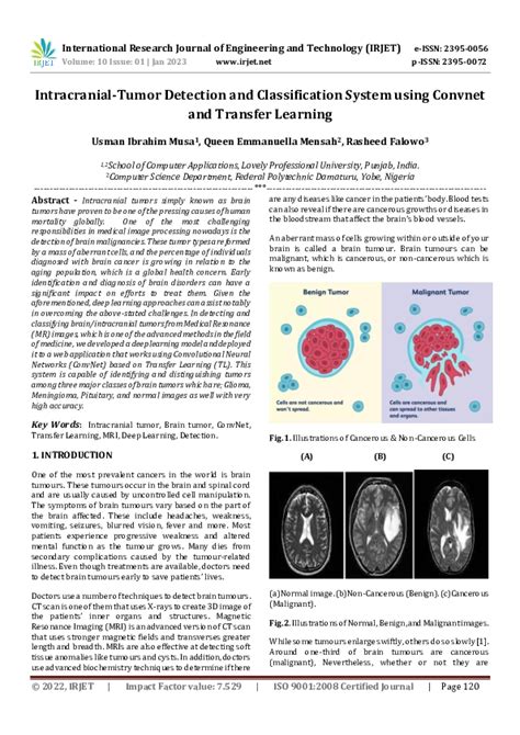 pdf intracranial tumor detection and classification system using convnet and transfer learning