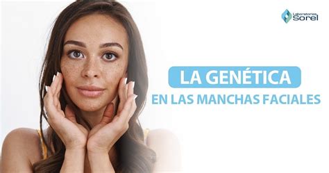 El Papel De La Genética En Las Manchas Faciales 2024