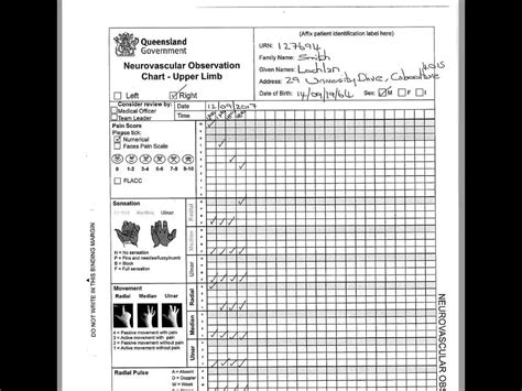 Neurovascular Observation Upper Chart