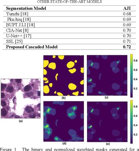 Figure From A Cascaded Deep Learning Framework For Segmentation Of