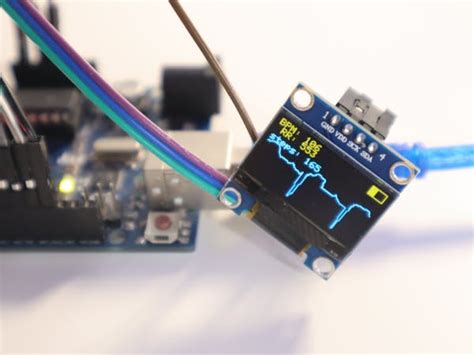 getting realtime ecg on oled screen arduino project hub