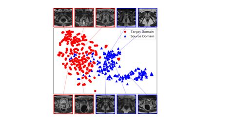boundary weighted domain adaptive neural network for prostate mr image segmentation deepai