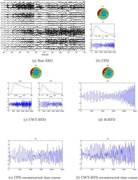 ictal eeg and its tensor decompositions in patient 2 a a segment of download scientific
