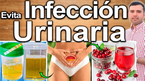 Dolor Al Orinar NUNCA MÁS Soluciones y Remedios Caseros Para La