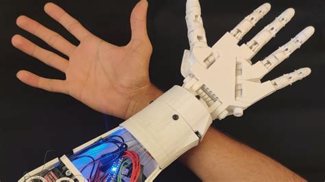 3D Printed EMG Prosthetic Hand YouTube