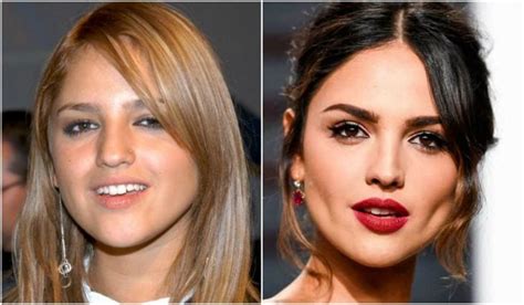 Celebridades Antes Y Despu S De Operarse La Nariz