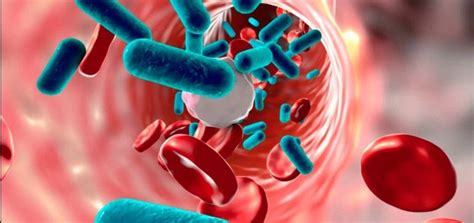 Infecciones Recurrentes Qu Son S Ntomas Y Diagn Stico Top Doctors