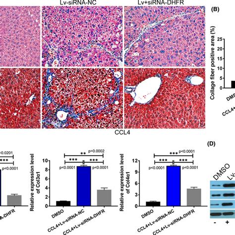 DHFR Knockdown Alleviated CCL4induced Hepatic Fibrosis In Mice