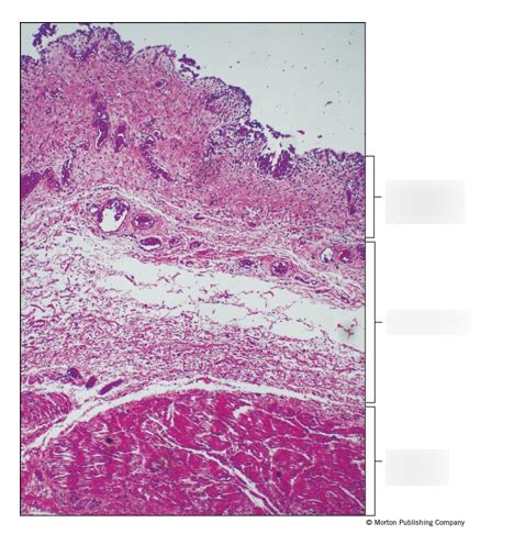 Bsc Lab Exam Urinary Bladder Histology Diagram Quizlet