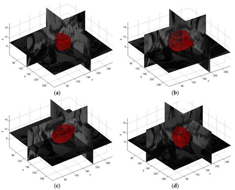 information free full text automated prostate gland segmentation based on an unsupervised
