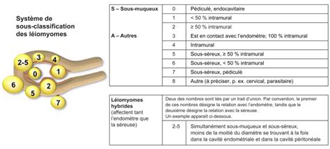 Prise en charge des léiomyomes utérins Journal of Obstetrics and