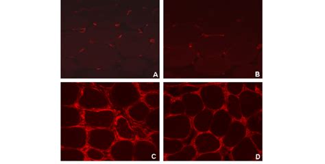 Immunofluorescence Staining Of MHC Class I And Class II In