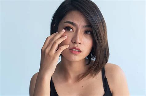 Ini Penyebab Mata Kedutan Sebelah Kanan Dan Penanganannya
