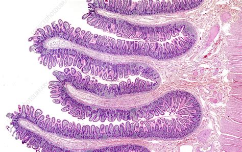 Small Intestine Light Micrograph Stock Image C057 0440 Science