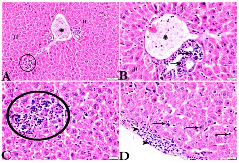 Photomicrograph Of H E Stained Liver Tissue Sections From Toxoplasma