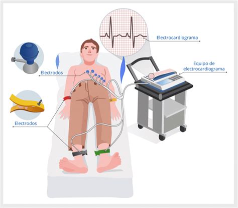 Medicina General Universal Que Es Un Electrocardiograma Porn Sex Picture