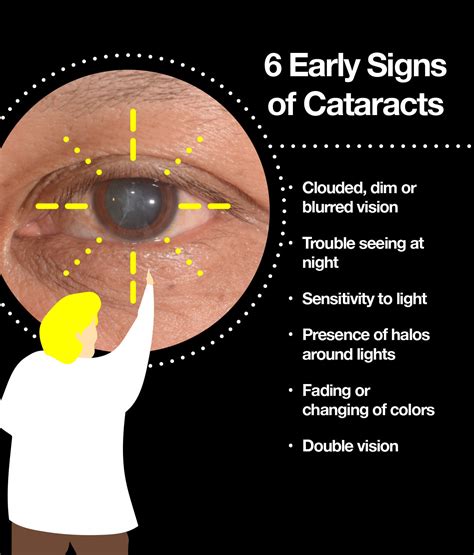 Understanding Cataract Causes Symptoms And Treatment Ask The Nurse
