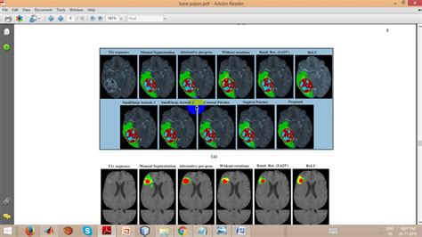 automatic brain tumor segmentation using convolutional neural networks images