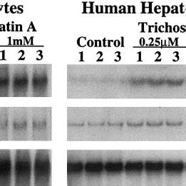 Effect Of Trichostatin A On MAT2A Expression In Normal Rat And Human
