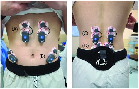 Locations Of The Placement Of Electrodes A Rectus Abdominis B