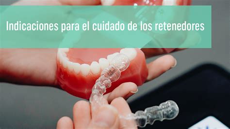 Indicaciones Para El Cuidado De Los Retenedores