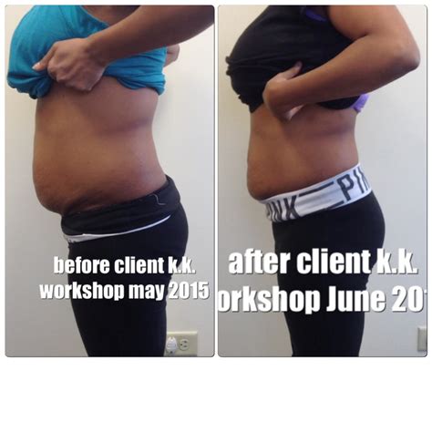 All New Before And After Pictures Healing The Diastasis Recti 2015