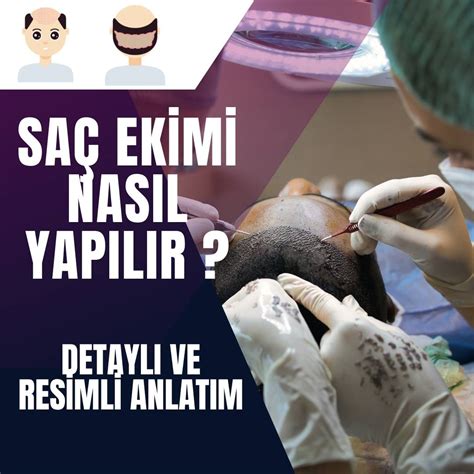 Saç Ekimi Nasıl Yapılır Resimli ve Detaylı Anlatım Saç Ekimi Bilgi