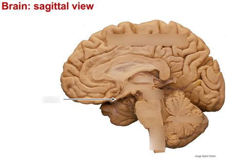 Brain Sagittal View Diagram Quizlet