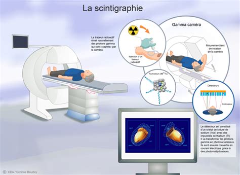 Scintigraphie Les C Dres Centre De M Decine Nuclaire