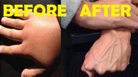 How To Get Veiny Hands Permanently Exercises YouTube