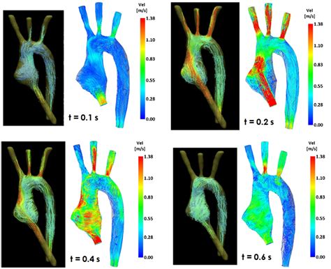 Frontiers Using 4D Cardiovascular Magnetic Resonance Imaging To