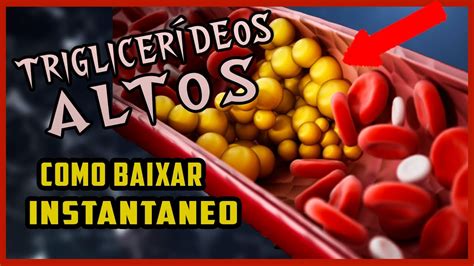 Como Baixar Triglicer Deos Alto Rapidamente O Que Fazer Youtube