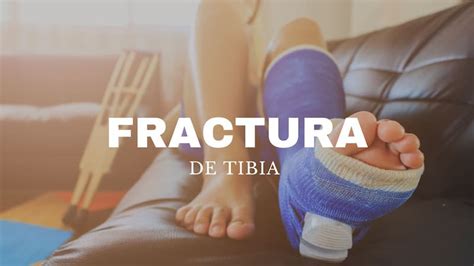 Fractura de tibia y peroné tiempo de recuperación rehabilitación y