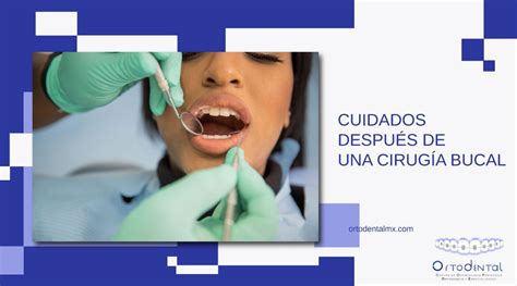 Cuidados después de una cirugía bucal Ortodental